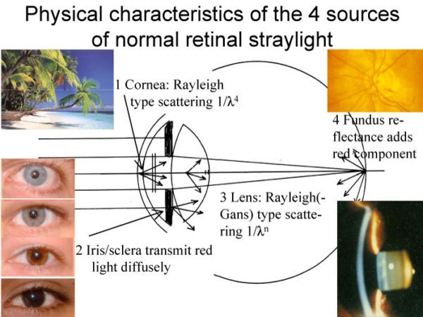 Straylight basics - Netherlands Institute for Neuroscience - Master the ...